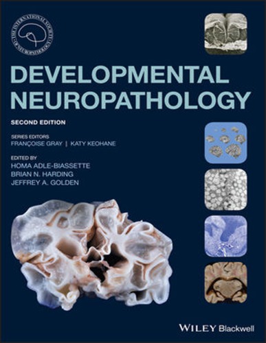 Ebook – Developmental neuropathology (PDF Instant Download) – Elibs Store