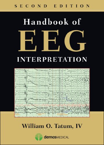 Ebook – Handbook of EEG Interpretation – 2nd Edition (PDF Instant ...